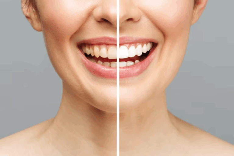 Top Foods That Stain Teeth & How Whitening Can Brighten Your Smile ...